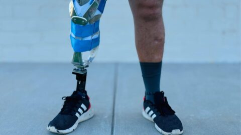 BK Socket | Slingshot Bionics