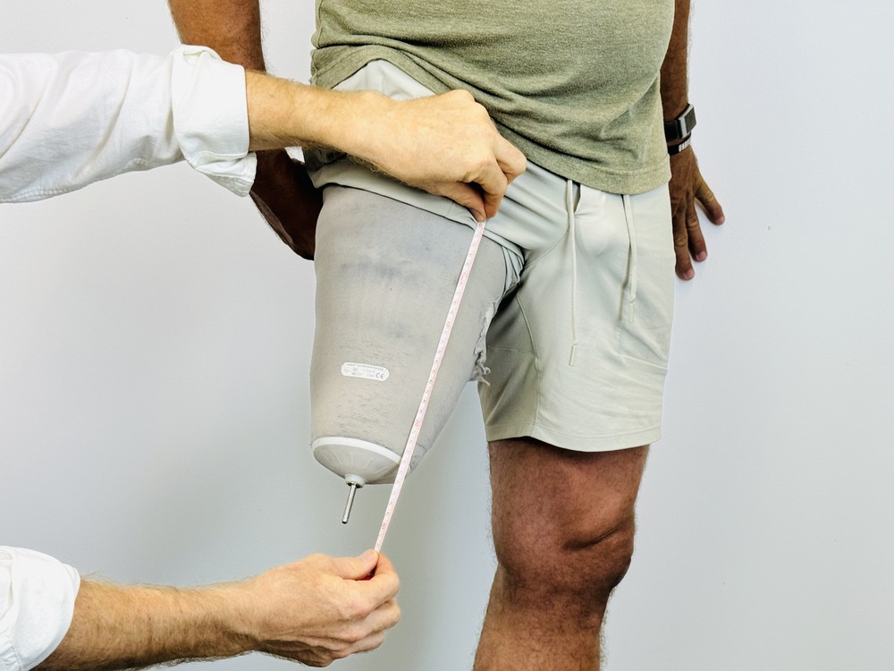 AK Limb Measurement Form | Slingshot Bionics